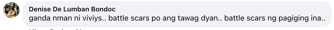 Expectation vs. Reality: Viy Cortez Gets Real With Her Body Image ...