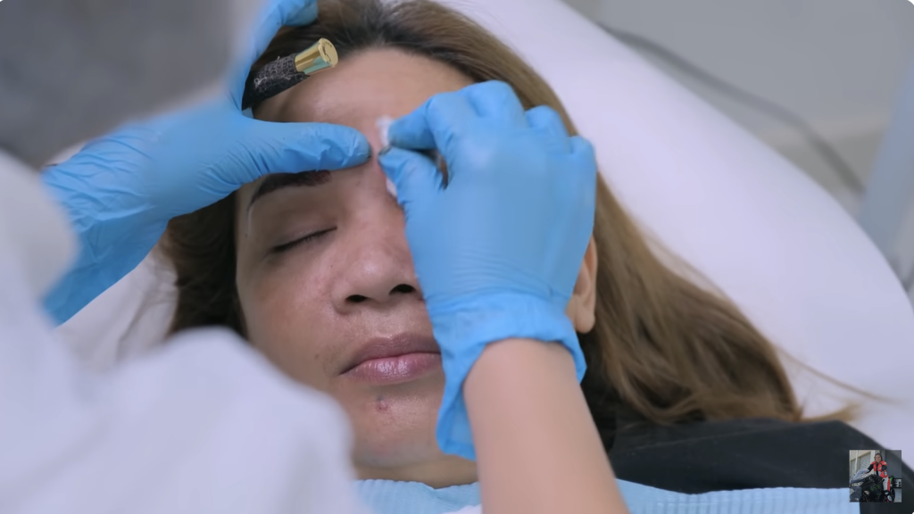Viy Cortez Grants Kidlat’s Babysitter’s Nose Makeover Request - ViyLine ...